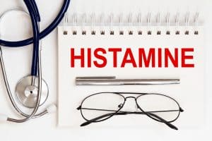 Is Coffee High in Histamine? What You Need to Know - Gourmet Coffee Lovers